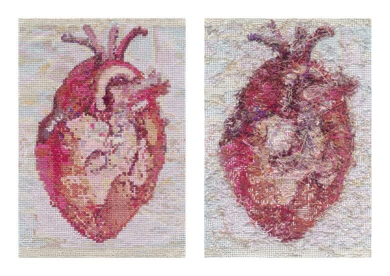 Two Human Hearts Stitched Together